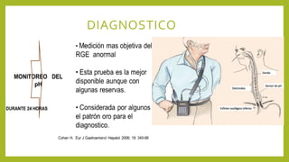 Comprehensive Overview of Gastroesophageal Reflux Disease (GERD ...