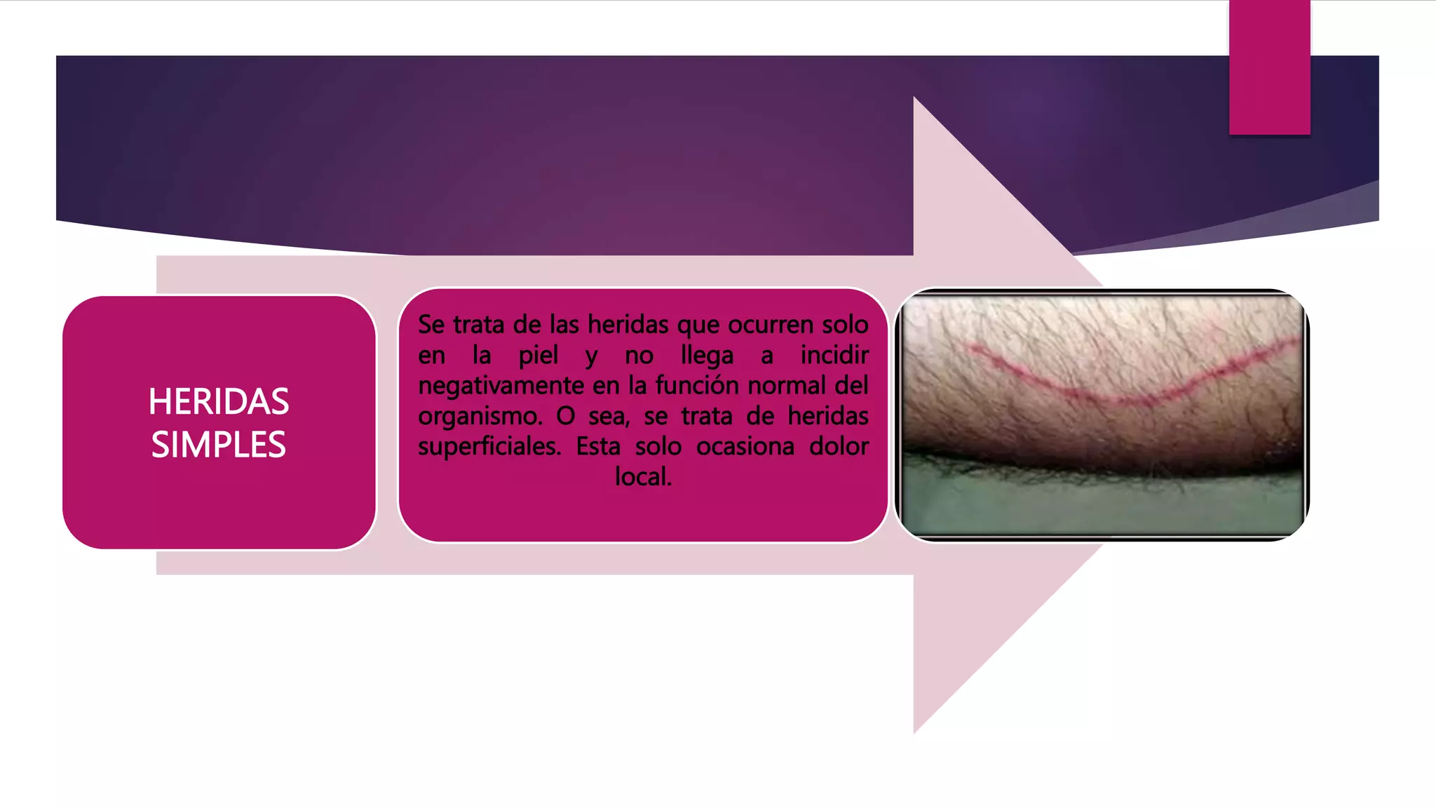 SESION 6, 7 HERIDAS.pptx