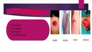 SESION 6, 7 HERIDAS.pptx