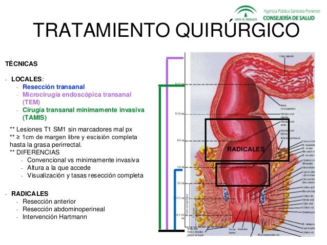 Cáncer rectal (diagnóstico y manejo. Carmen Molina. R2 Dig)