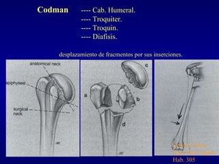 Necrosis Humeral. Posibilidades Quirúrgicas | PPT