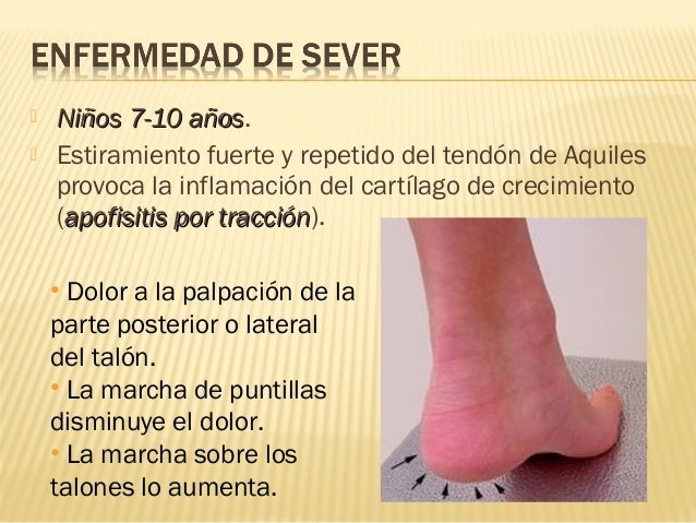 Sesión Clinica dolor en el talon