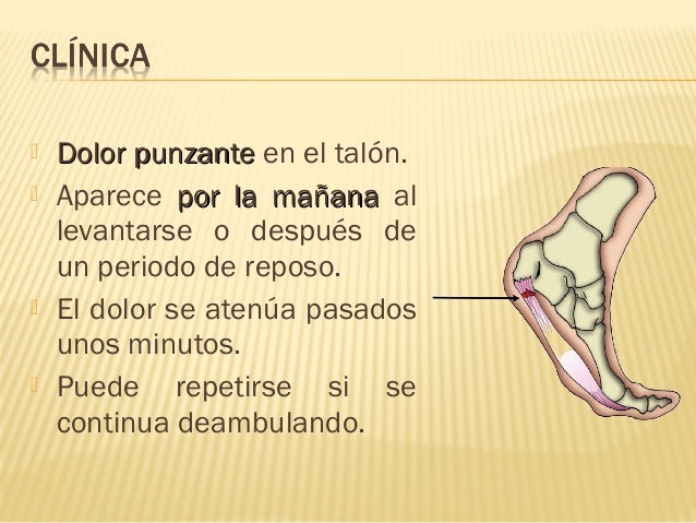 Sesión Clinica dolor en el talon