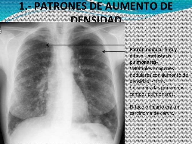 radiologia de torax