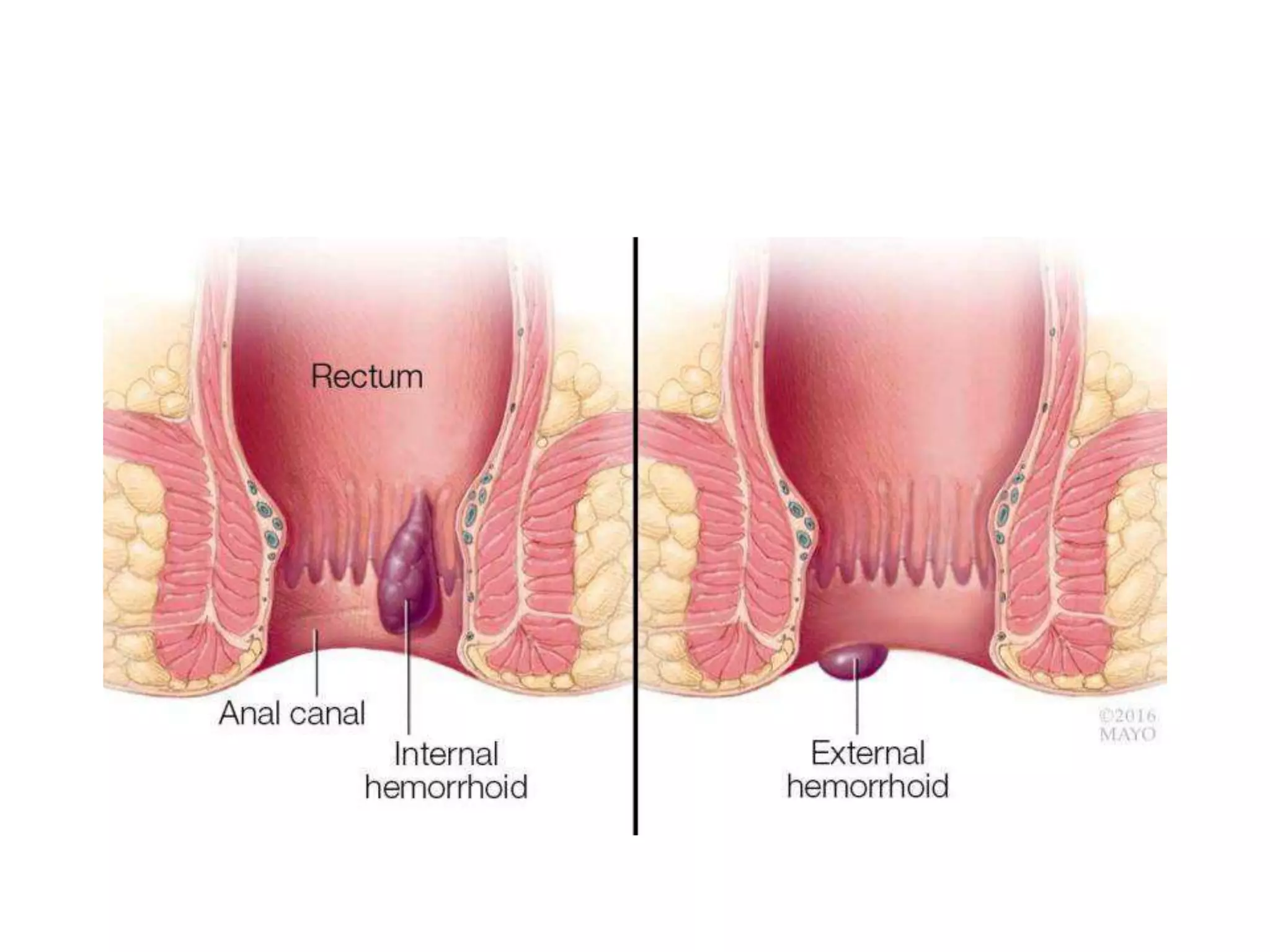 SESSION 14 MONICA LEADER.pptx