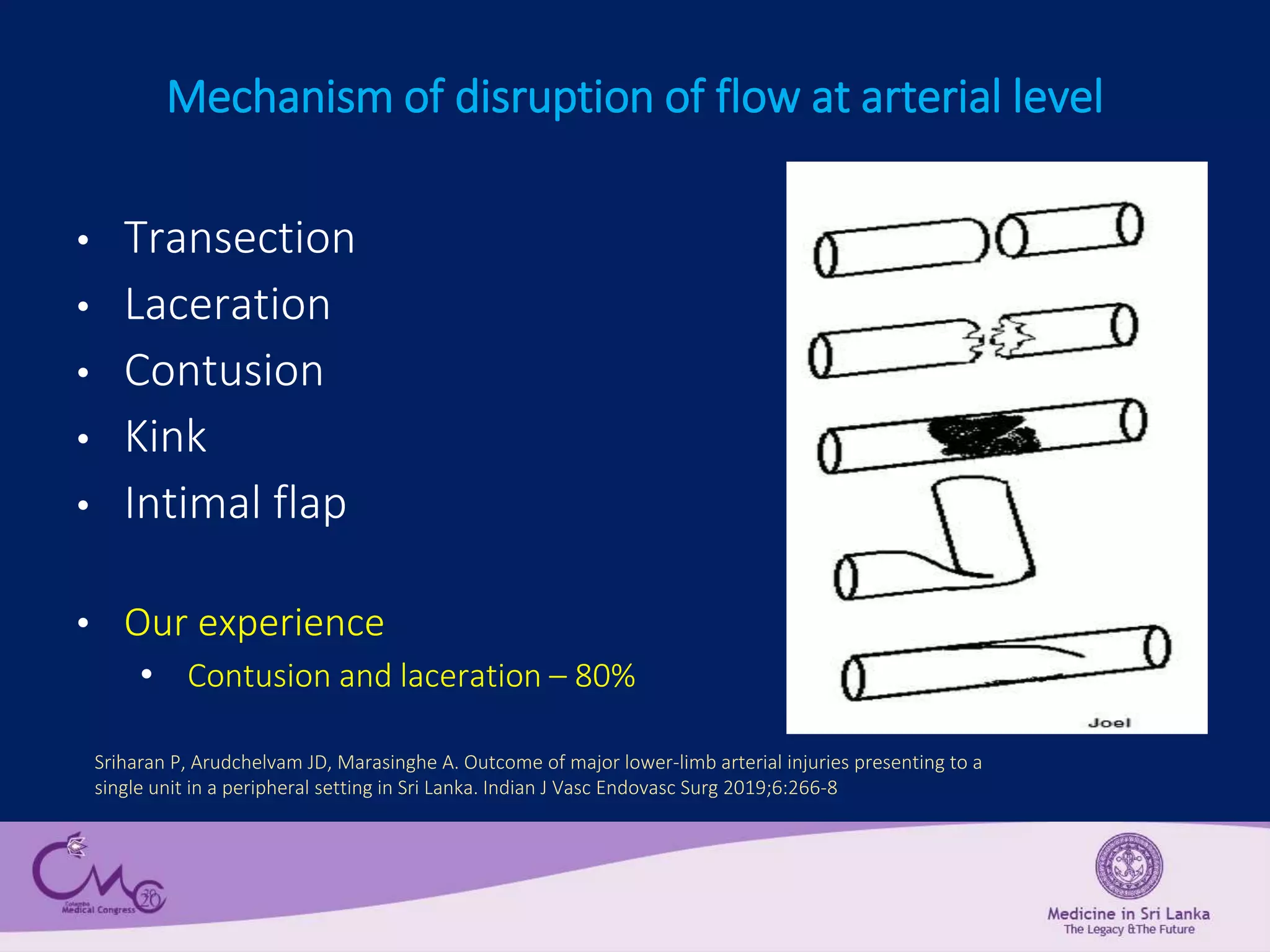Vascular Trauma The challenges for extremity vascular trauma in a ...