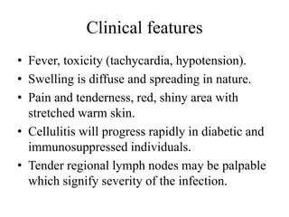 SESSION 19 - Cellulitis.pptx