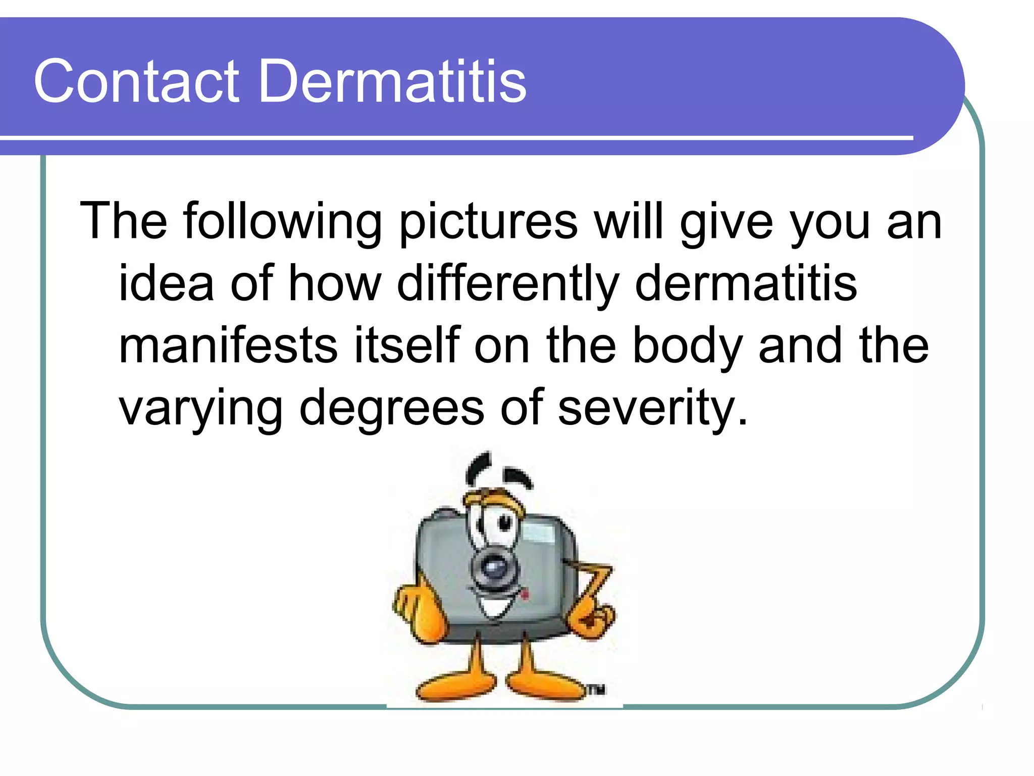 Dermatitis.ppt