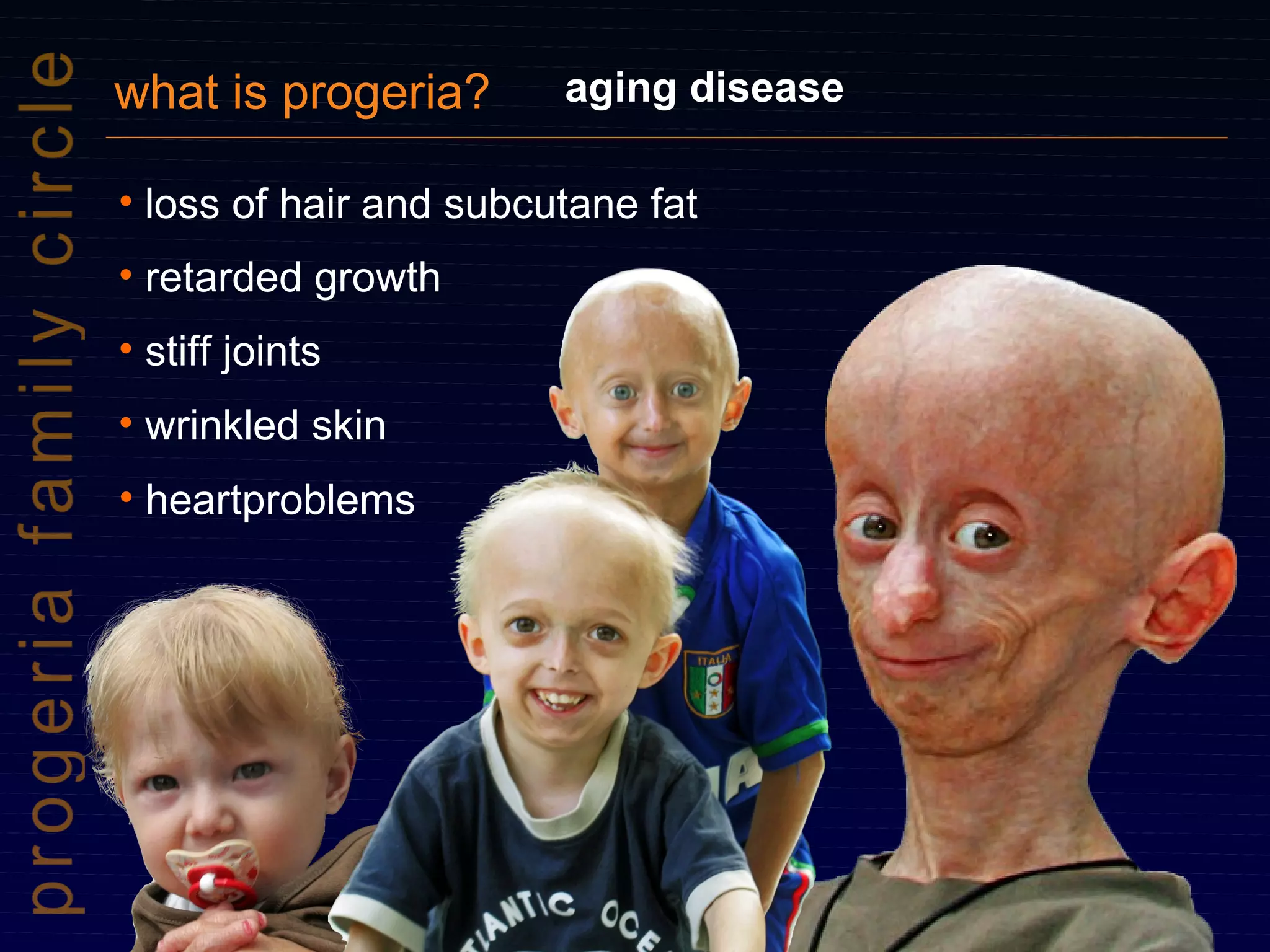 Session 21 progeria family circle ppt krakow + | PPT