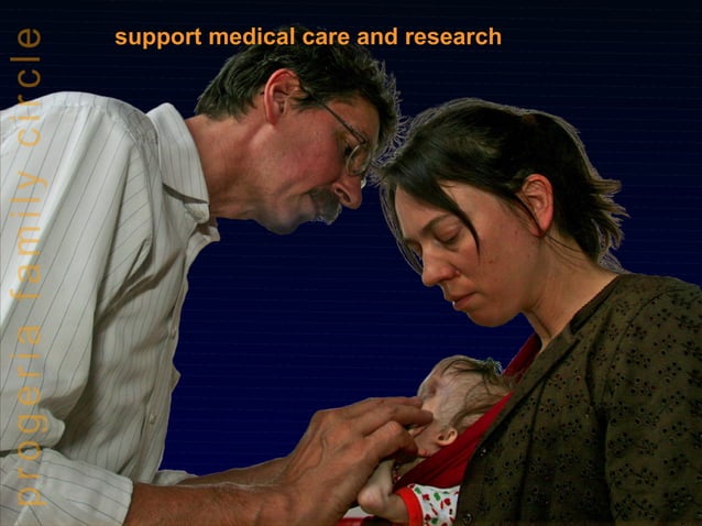 Session 21 progeria family circle ppt krakow + | PPT