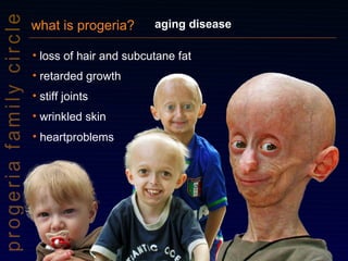 Session 21 progeria family circle ppt krakow + | PPT