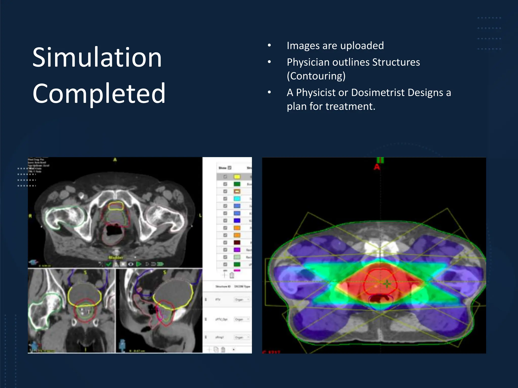 Session 3 - Treatment Simulation in RT.pptx