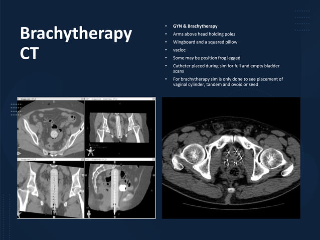 Session 3 - Treatment Simulation in RT.pptx
