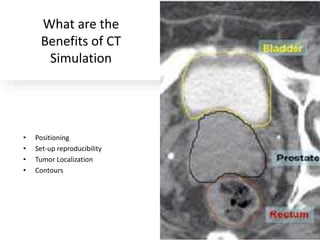 Session 3 - Treatment Simulation in RT.pptx