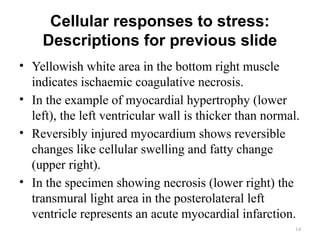 Session 3 Cellular responses to stress and noxious stimuli.pptx