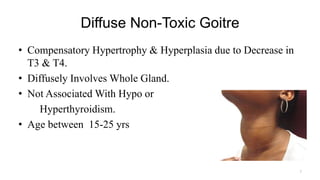 Goitre treatment and management accordingly | PPT
