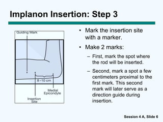 Session 4 a | PPTX | First Aid | Injuries