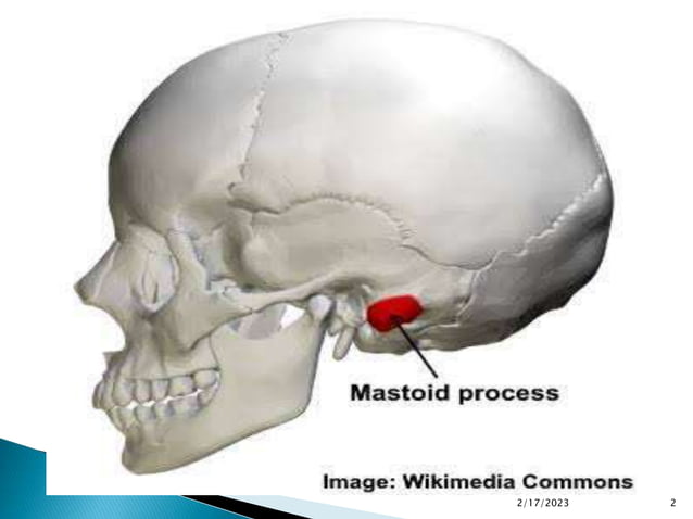 Session 5 Mastoiditis.pptx | Ear, Nose and Throat Conditions | Diseases ...