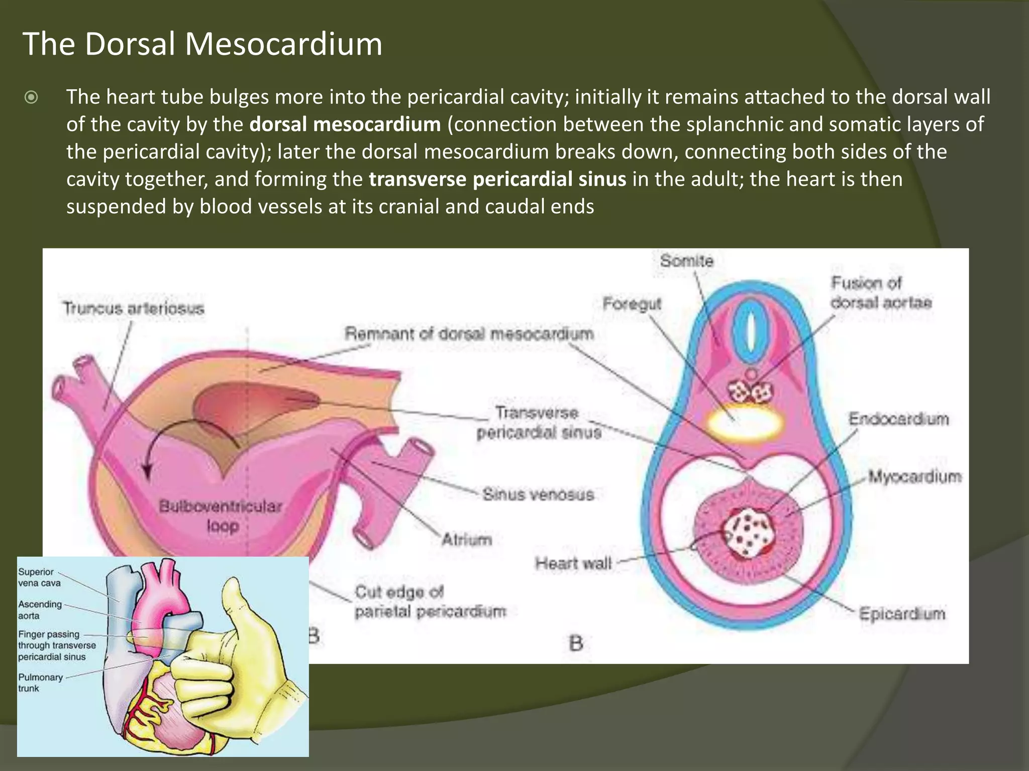 Embryology Course VI - Cardiovascular System | PPT