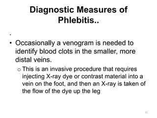 Session 7_ Care of A Patient with Phlebitis.ppt