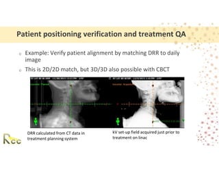 Session 8 - IGRT_ Guidelines for Matching _ Alignment, Methods ...