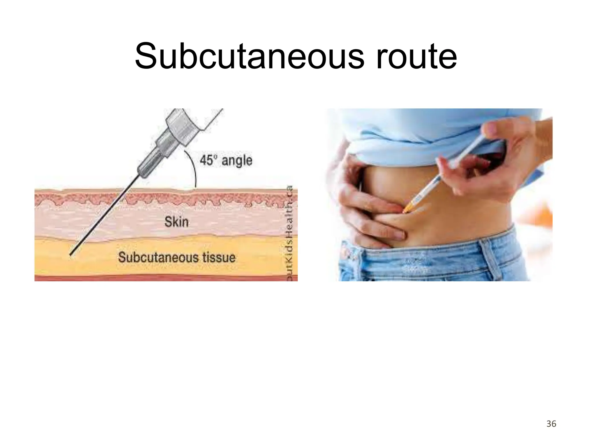 Session 8-ROUTES OF ADMINISTRATION.pptxs | PPTX | Ear, Nose and Throat ...