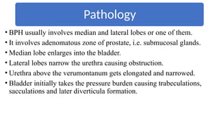 SESSION 9- Benign prostate hyperplasia(BPH).pptx