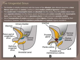 Urogenital Sinus