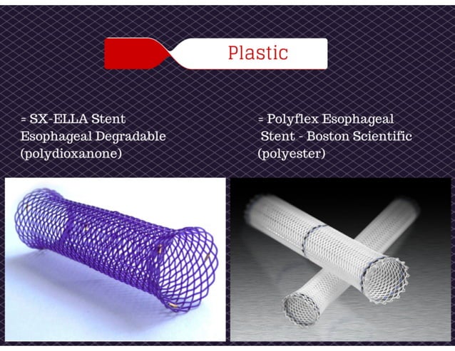 Self Expandable Stent Design | PDF