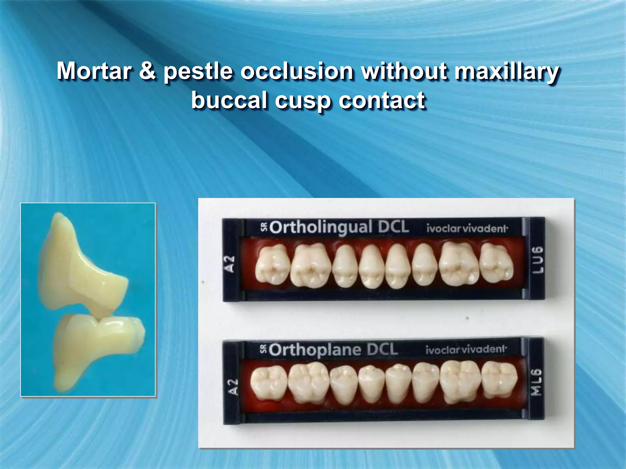 Set Posterior Teeth Ling & Monopl.ppt