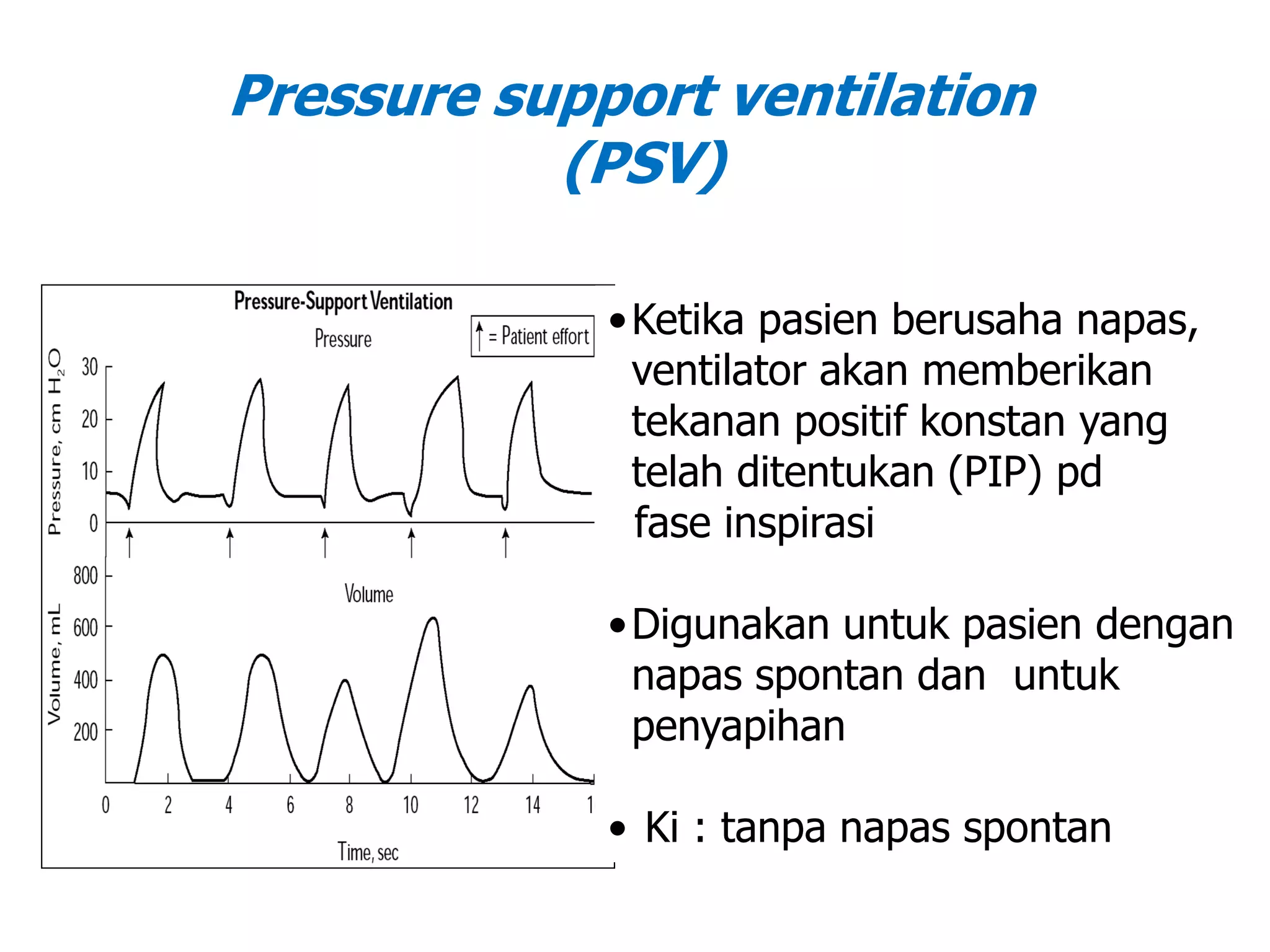 Setting awal venti untuk tentiran.pdf
