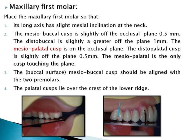 Setting maxillary posterior anatomic denture teeth cd 2nd yr | PPTX ...