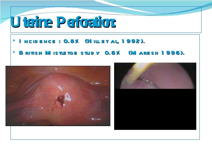 Setting of Hysteroscopy unit