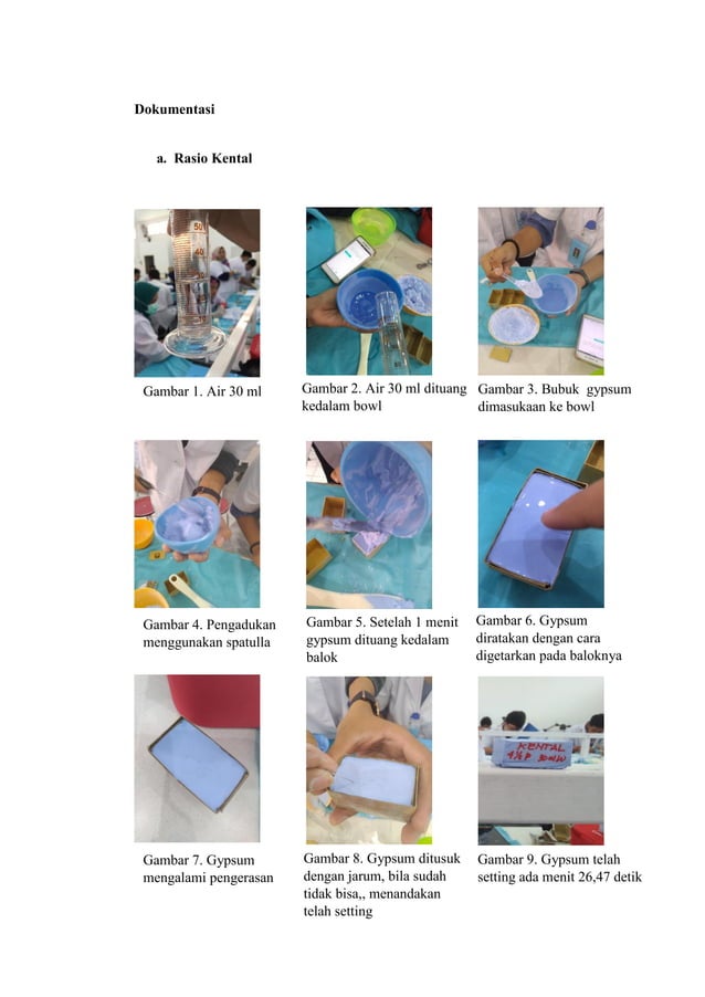 SETTING TIME GYPSUM TYPE III KEDOKTERAN GIGI RASIO W/P | PDF