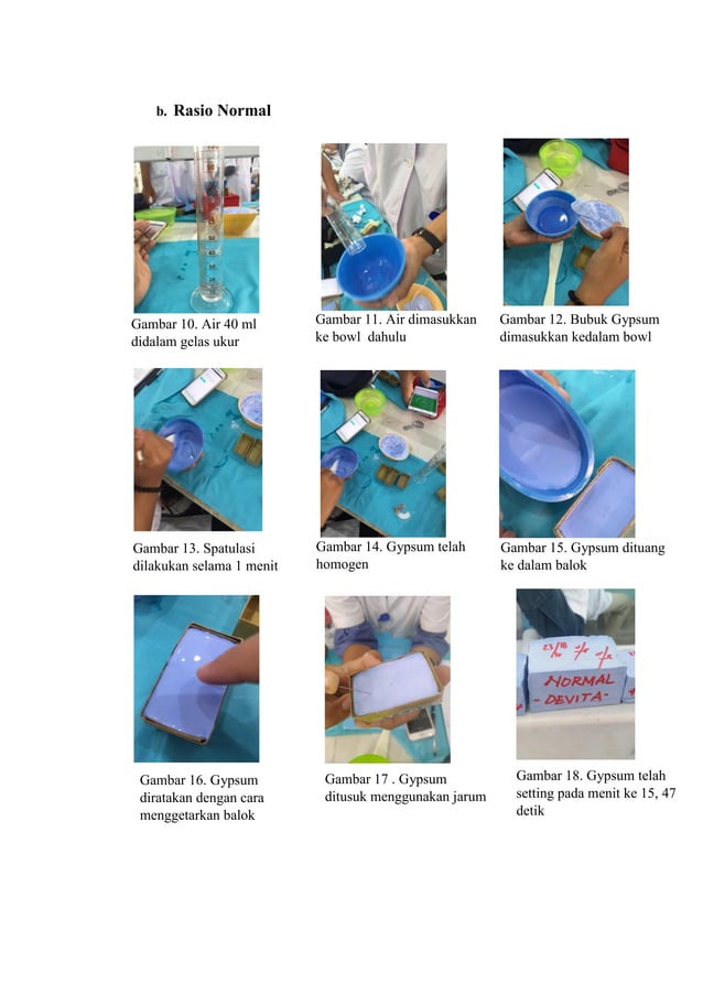 SETTING TIME GYPSUM TYPE III KEDOKTERAN GIGI RASIO W/P | PDF