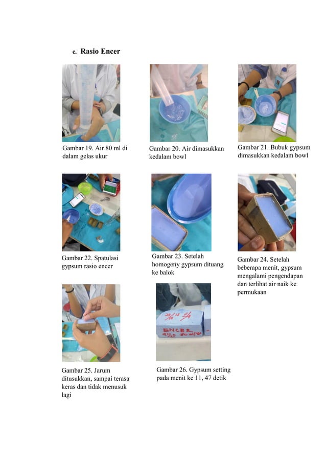 SETTING TIME GYPSUM TYPE III KEDOKTERAN GIGI RASIO W/P | PDF