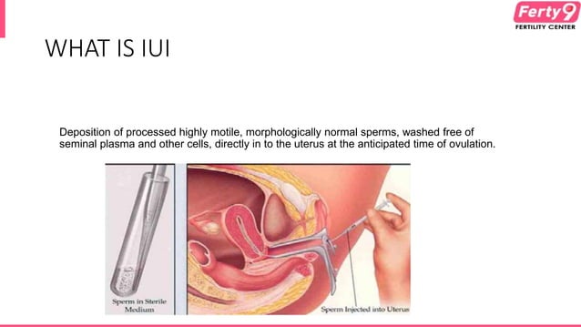 How to set-up IUI Laboratory I Jayaram Chandrasekar I Senior Embryologist I Republic of India ...