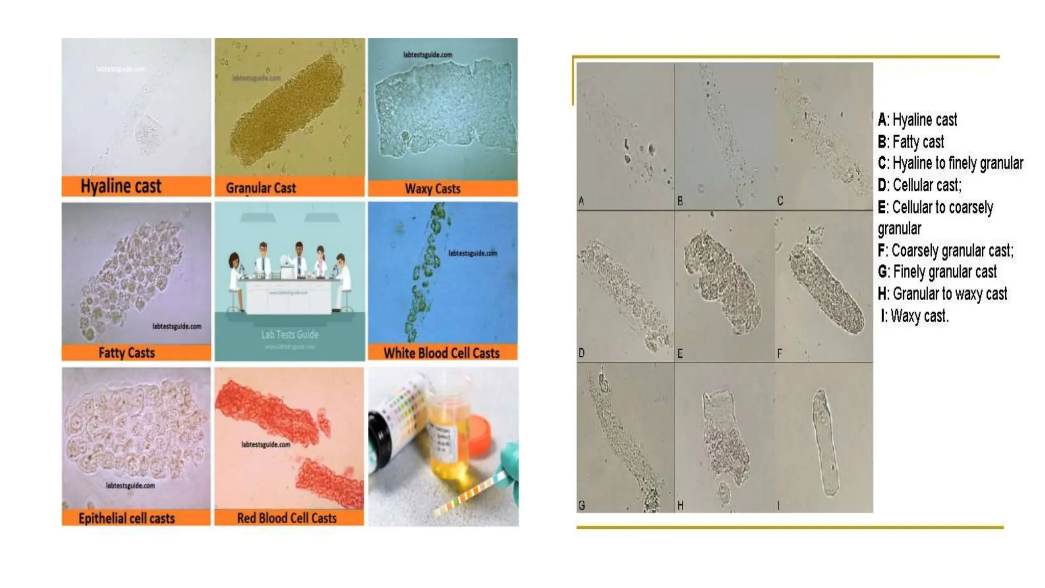 urine analysis labortory diagnosisn work ppt | PPTX
