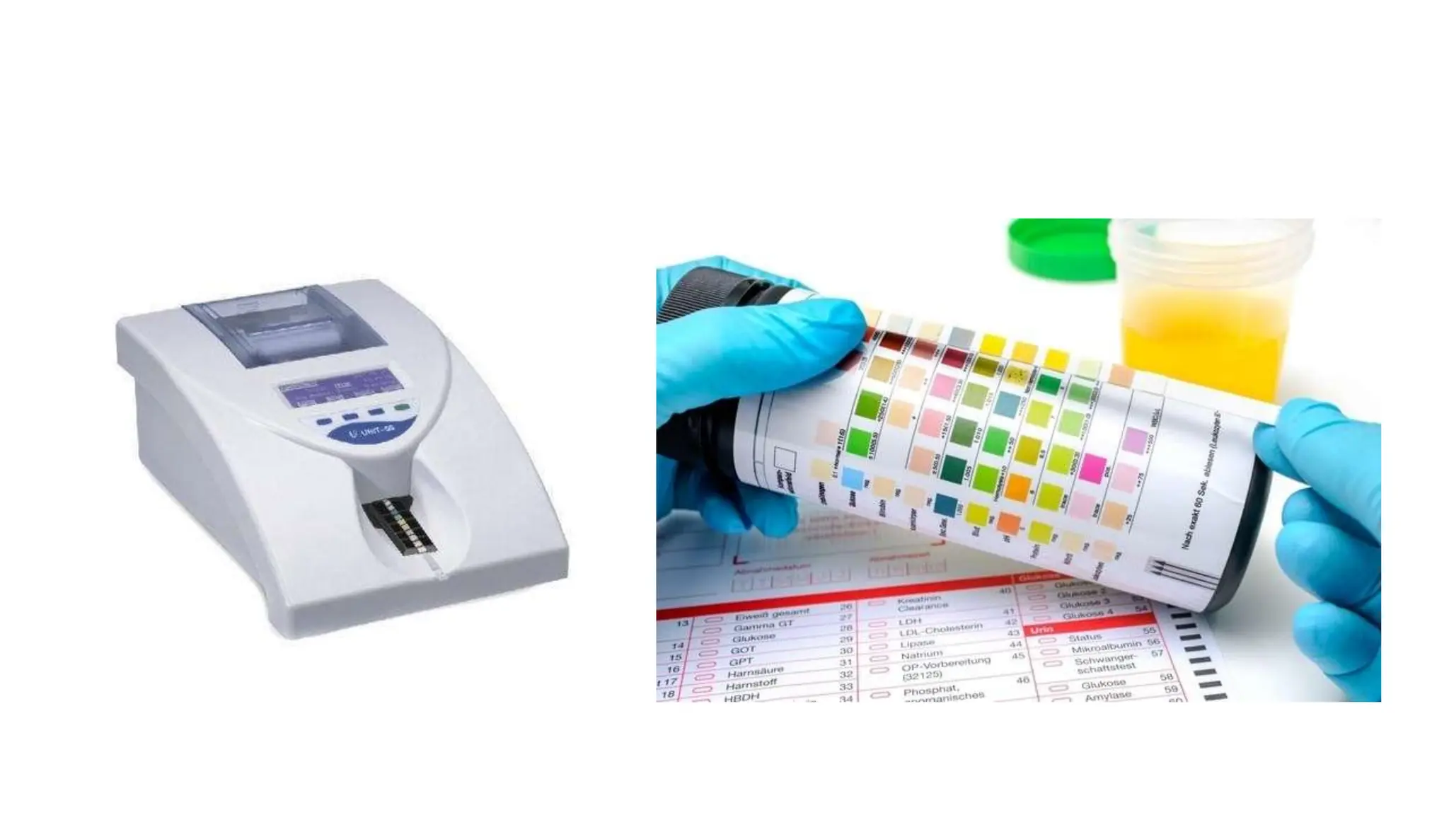 urine analysis labortory diagnosisn work ppt | PPTX