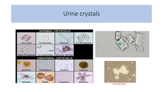 urine analysis labortory diagnosisn work ppt | PPTX