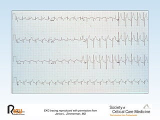 Severe Sepsis & Septic Shock | PPT