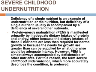 Severe Acute Malnutrition.ppt