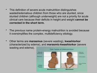 SEVERE ACUTE MALNUTRITION Pediatrics.pptx