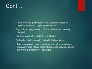 Severe Acute Malnutrition - Copy.ppt