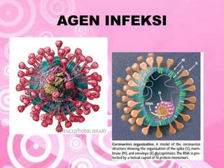 Severe acute respiratory syndrome | PPT