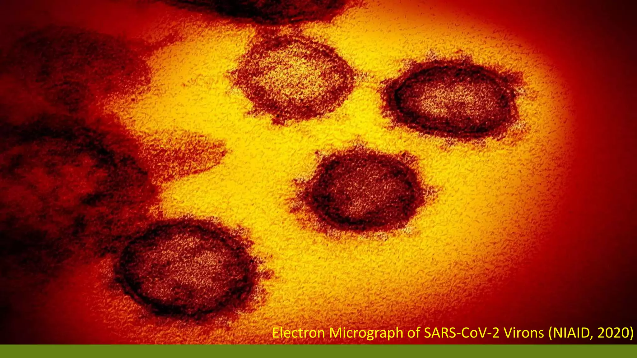 Severe Acute Respiratory Syndrome Coronavirus 2 (SARS-CoV-2) | PPTX
