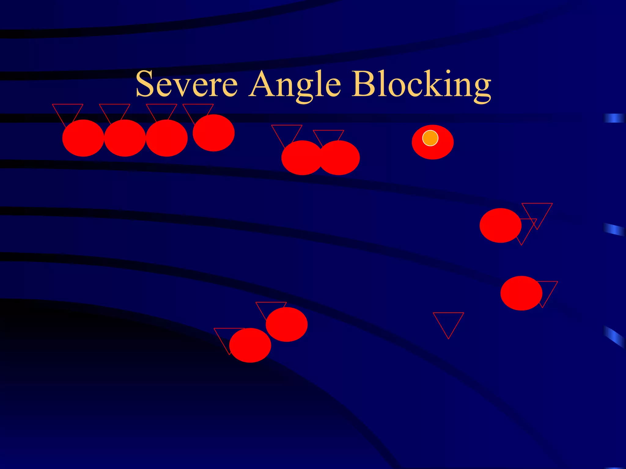 Severe Angle Blocking By Jack Gregory | PPT
