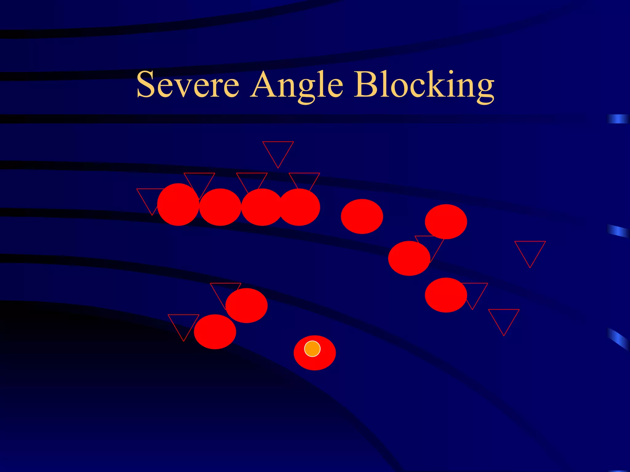 Severe Angle Blocking By Jack Gregory | PPT