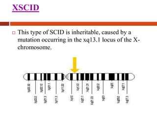 Severe combined immunodeficiency | PPTX