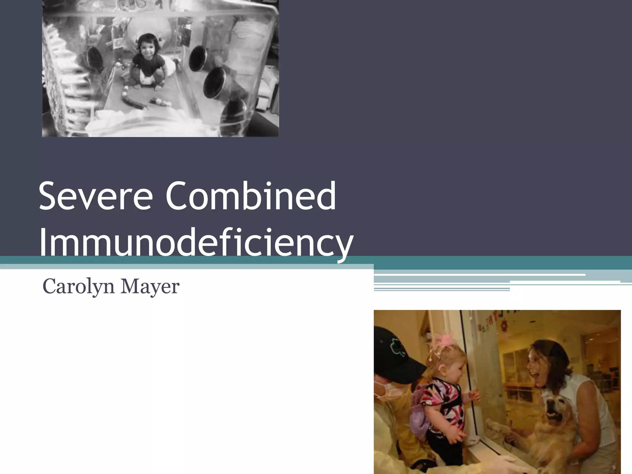 Severe Combined Immunodeficiency | PPT